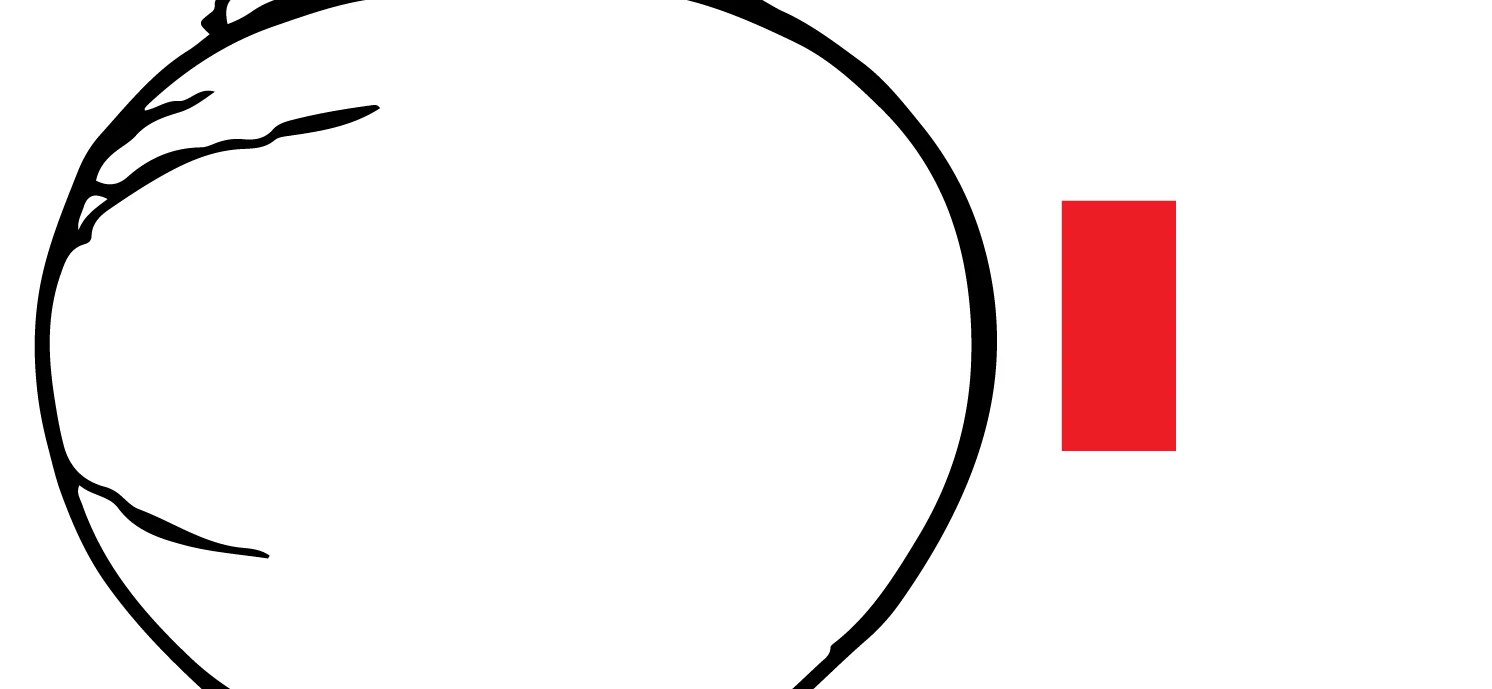 creating a stroke on the outside of an object | Community